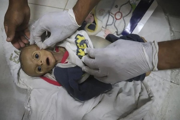 In Gaza, a Baby Dies Weighing Less Than at Birth